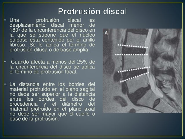Hemangioma y protrucion discal por resonancia magnetica