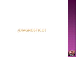 Caso clinico tiroiditis | PPTX