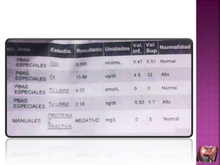 Caso clinico tiroiditis | PPTX