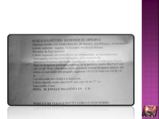 Caso clinico tiroiditis | PPTX