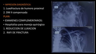 CASO CLINICO TRAUMATOLOGIA FRACTURA HUMERI | PPTX