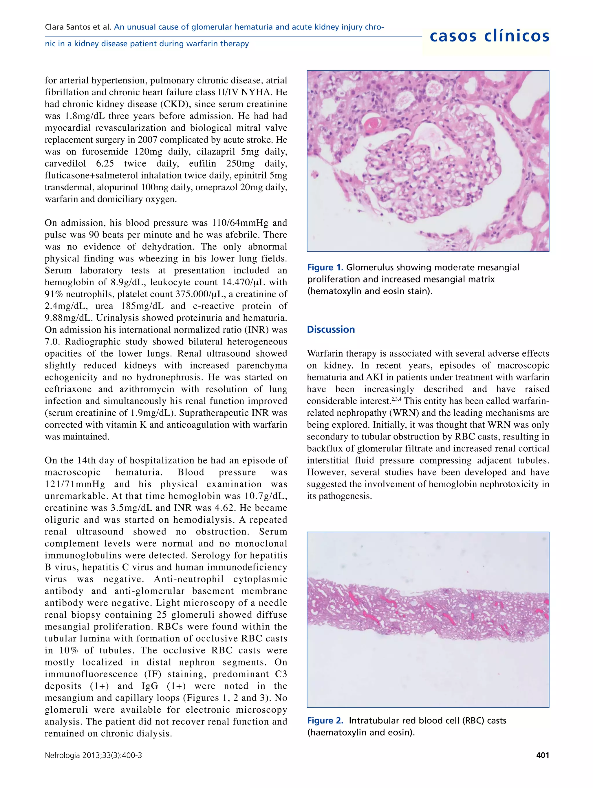 Caso clinico uroanalisis | PDF