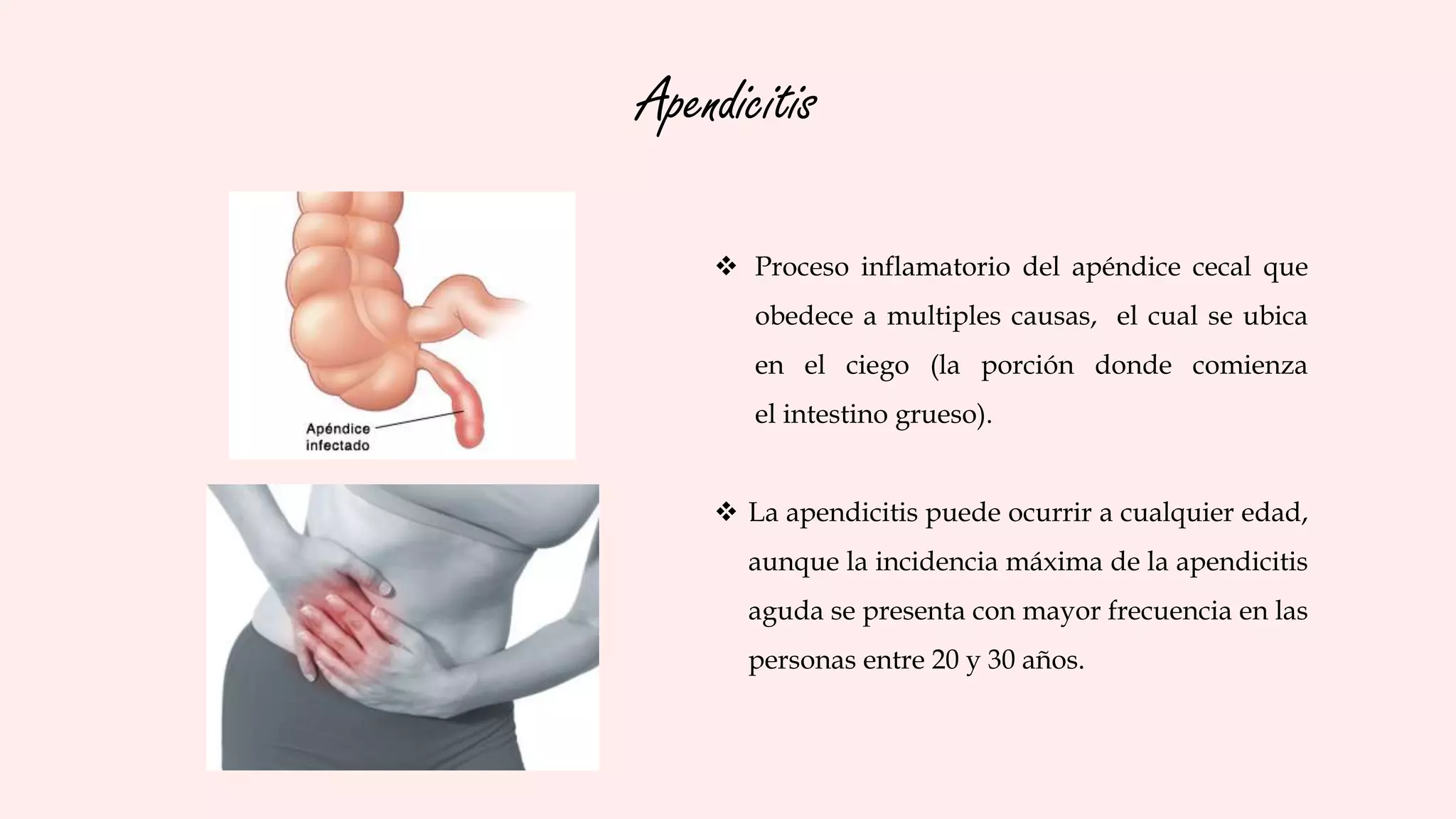 Apendicectomia (Quirúrgica) | PPTX | Ear, Nose and Throat Conditions ...