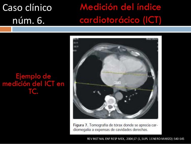 Caso clínico tomográfico núm. 6 HMZ