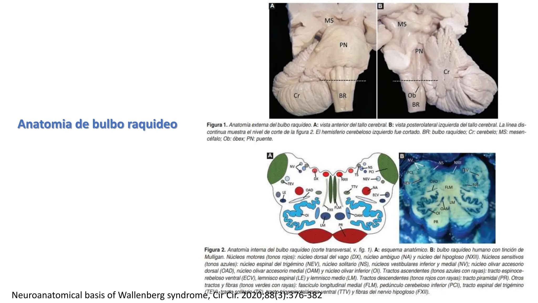 CASO CLÍNICO EVC.pptx caso clinico medicina interna | PPTX