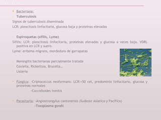 Caso clínico meningitis | PPT