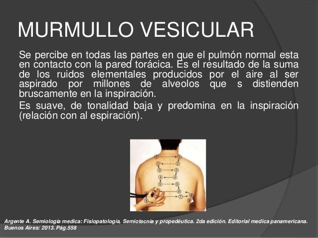 Caso clínico n 1 lupus eritematoso