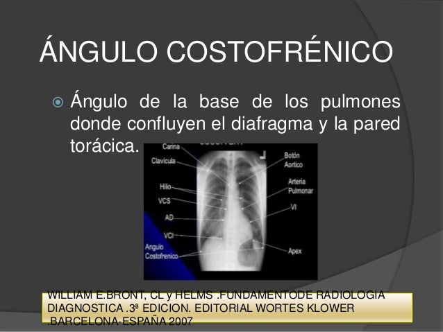 Caso clínico n 1 lupus eritematoso