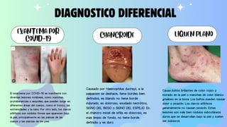 Caso Clínico Sífilis en paciente masculino | PDF