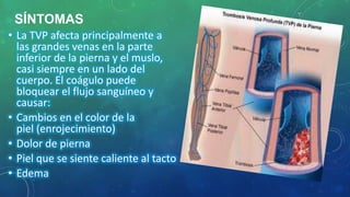 Caso clínico trombo flebitis arterovenosa profunda | PPTX