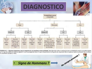 Caso clínico trombosis venosa profunda | PPTX