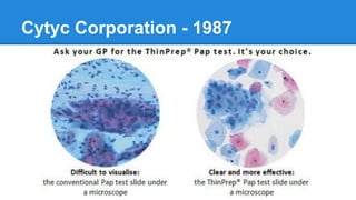 "Stan Lapidus: Profile of a Medical Entrepreneur." | PPTX