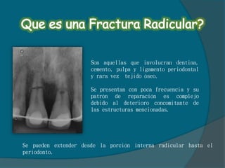 Caso Clinico Fractura Vertical | PPTX