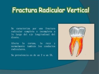 Caso Clinico Fractura Vertical | PPTX