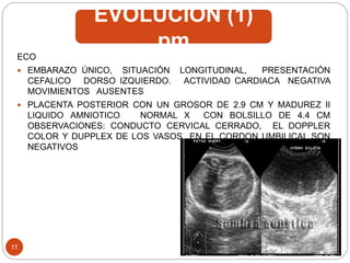 CASO GINECOLOGIA.pptx