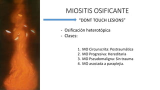 Lectura de caso: Miositis osificante | PPTX