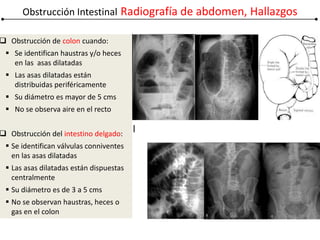 Caso radiologia r1 | PPTX