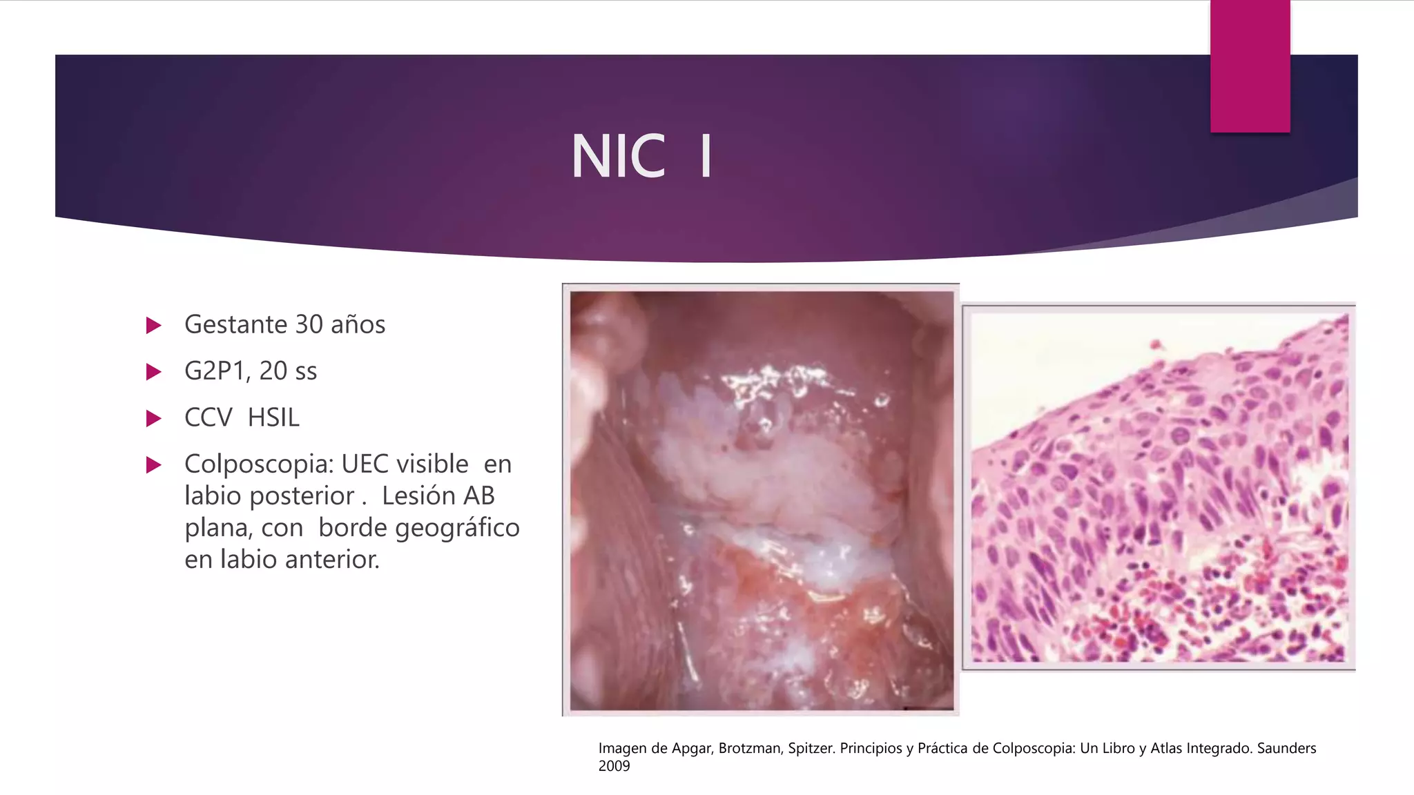 CASOS CLINICOS COLPOSCOPIA.pptx