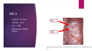 CASOS CLINICOS COLPOSCOPIA.pptx