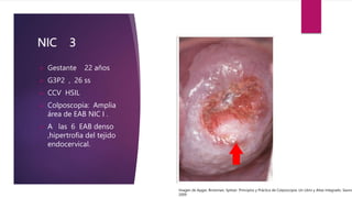CASOS CLINICOS COLPOSCOPIA.pptx