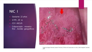 CASOS CLINICOS COLPOSCOPIA.pptx