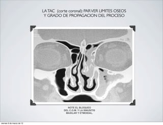 Casos clinicos nariz y senos | PDF