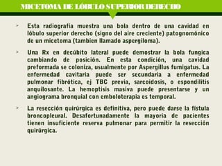 CASOS CLINICOS RADIOGRAFIAS DE TORAX by Rudy Paucara | PPT