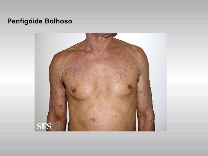 Casos ClíNicos Em Dermatologia