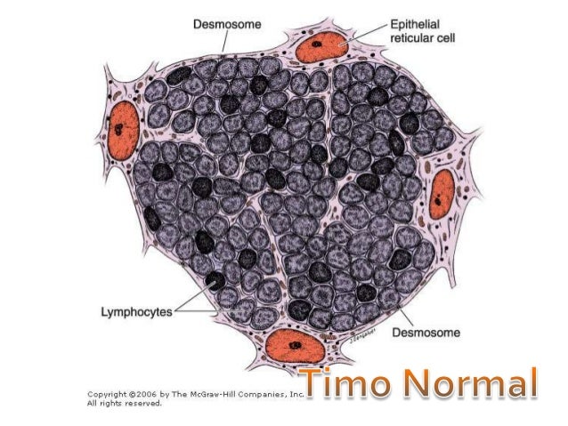 Timoma (revisión del tema)