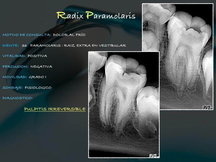 Radix Paramolaris