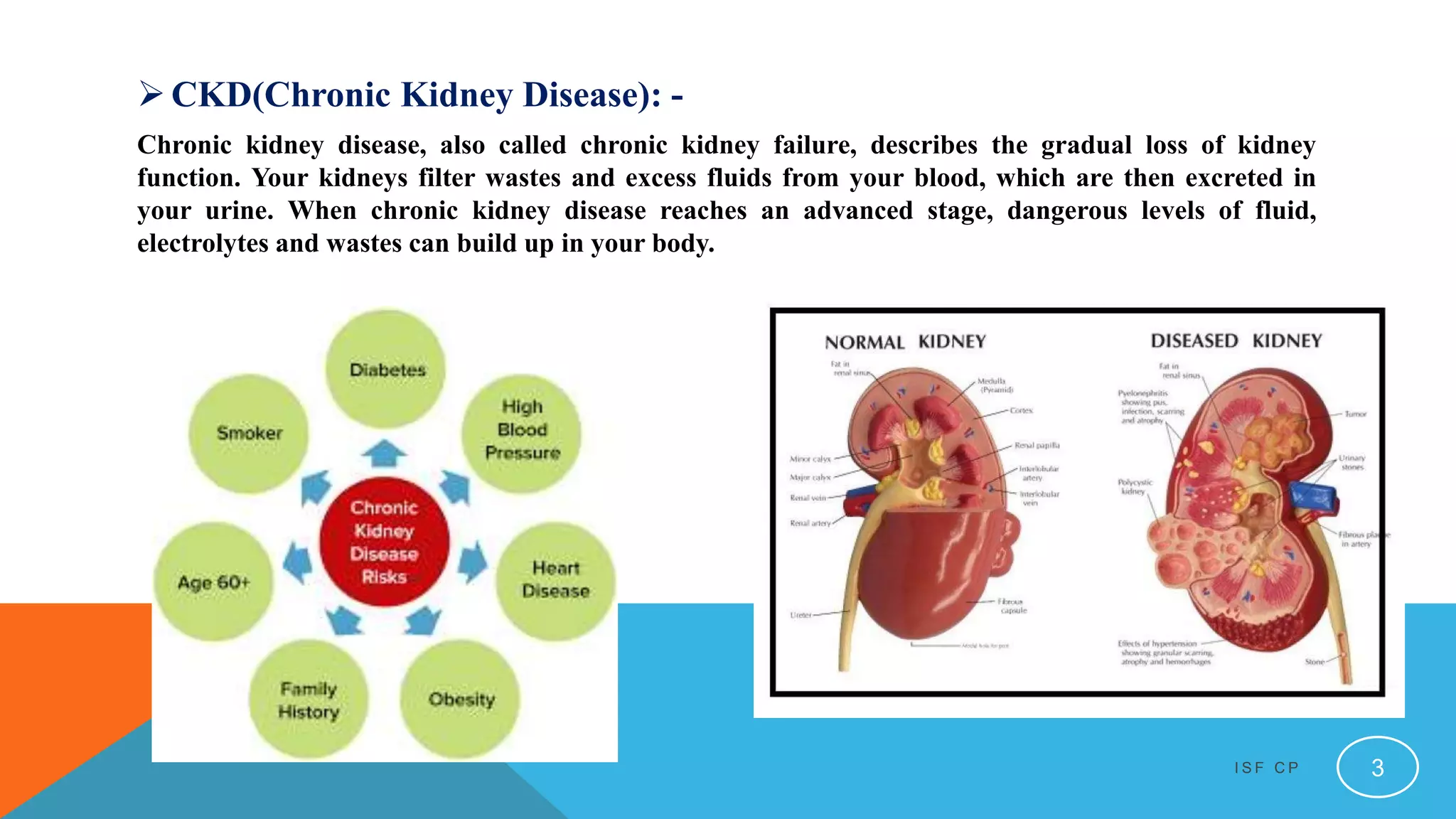 Casr study on ckd,htn,dm 2 | PPT