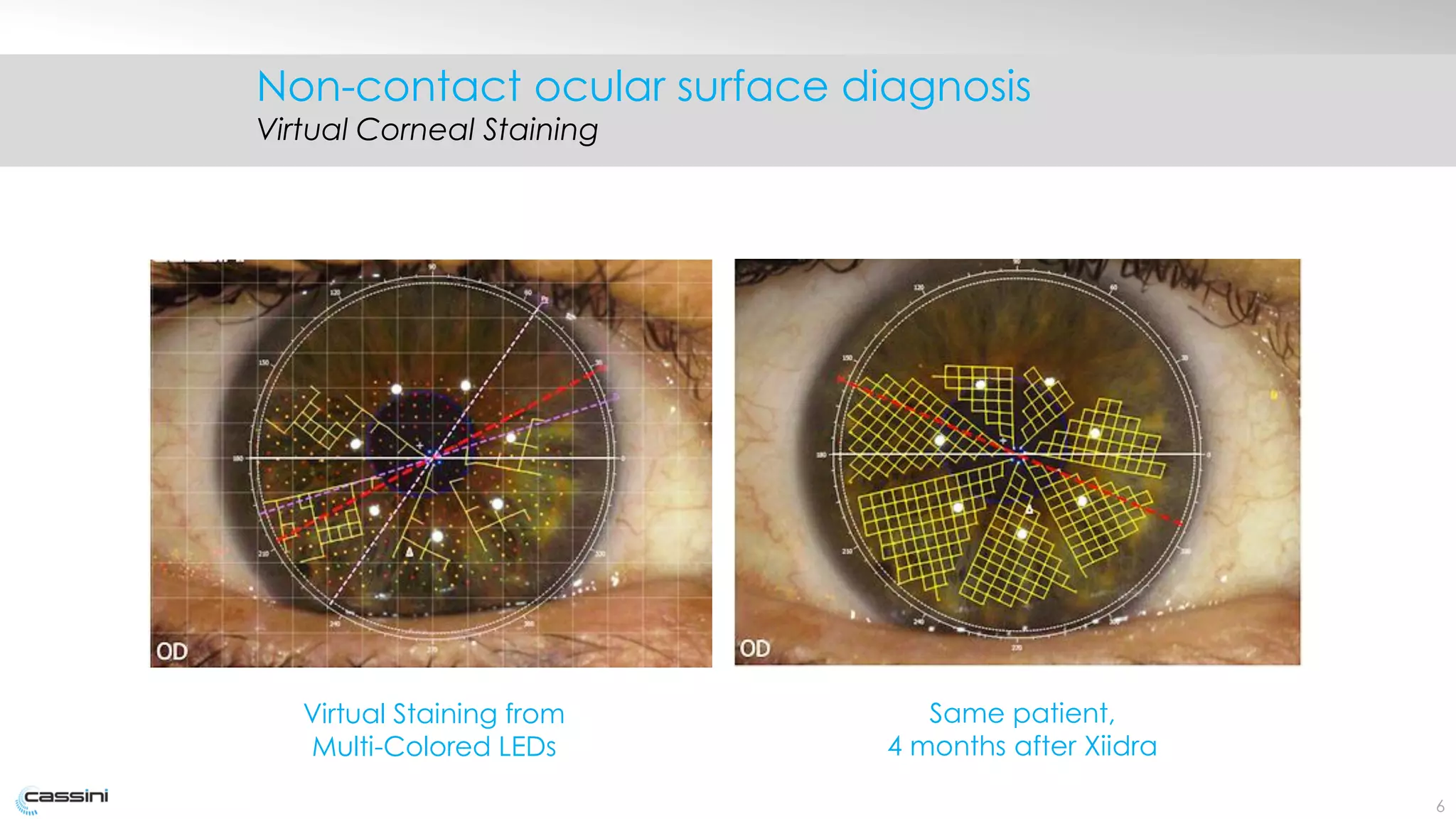 Ophthalmology Innovation Showcase 1 - Cassini | PDF