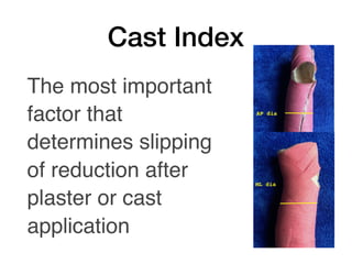 Cast Index | PDF
