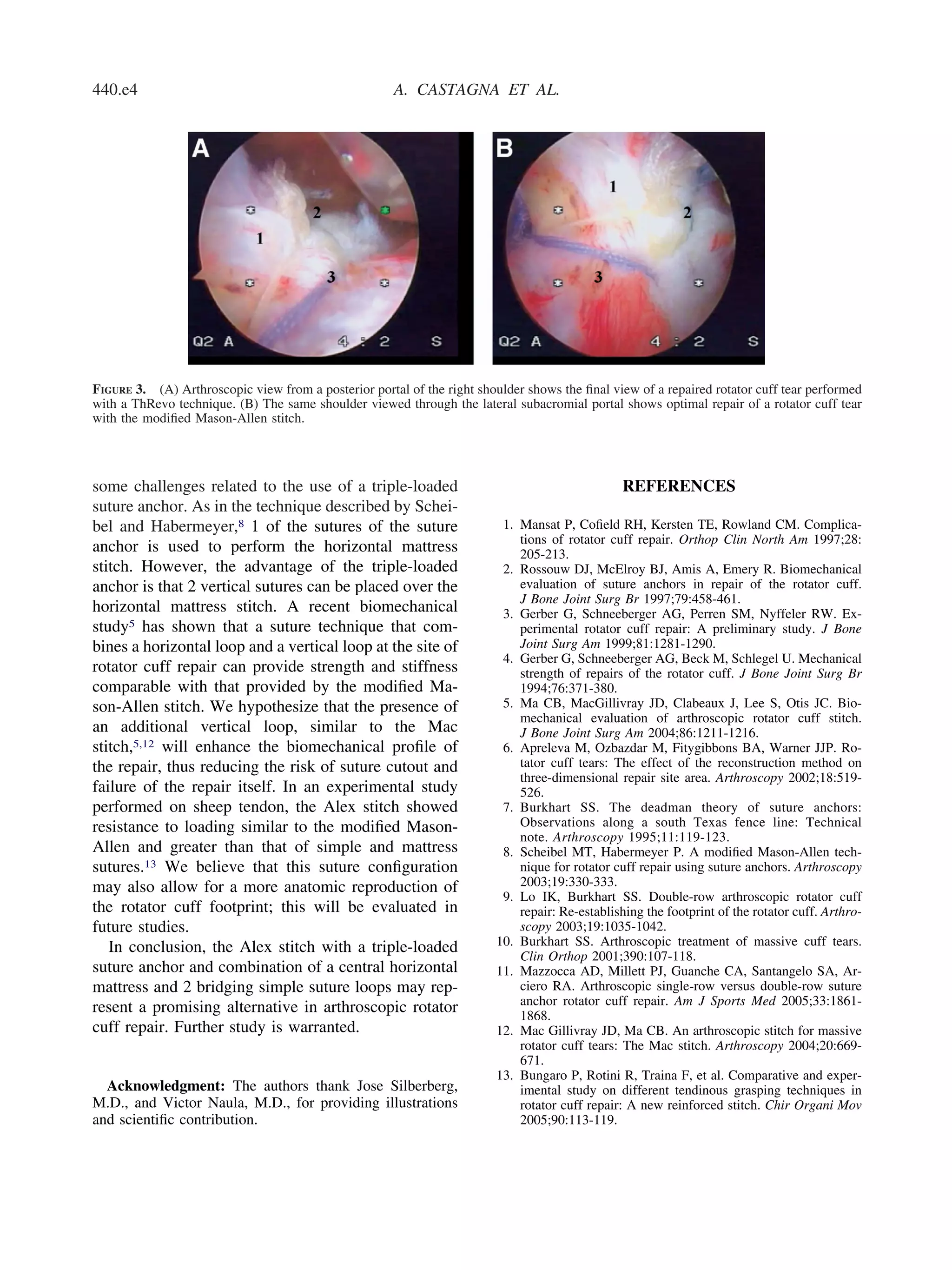 Castagna 2007- arthroscopic rotator cuff repair using a triple-loaded suture anchor and a ...
