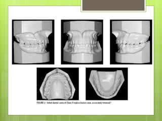 Cast analysis | PPTX