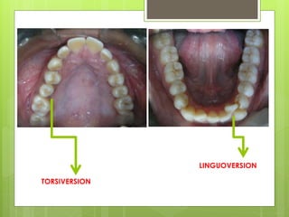 Cast analysis | PPTX