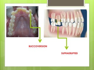 Cast analysis | PPTX