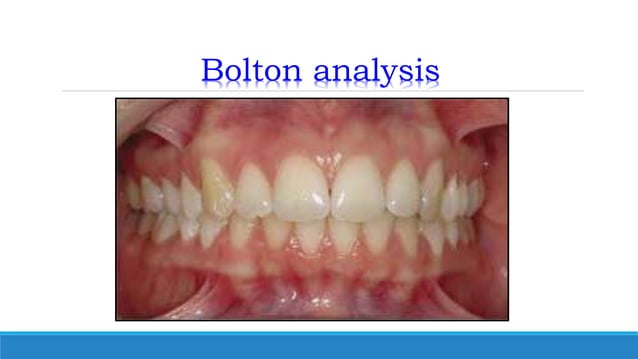 Cast analysis | PPTX