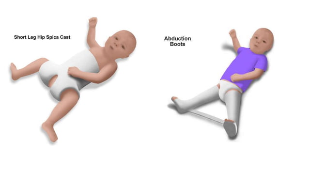 Cast and immobilization techniques in orthopaedics by Dr O.O. Afuye | PPTX