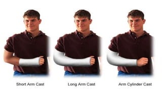 Cast and immobilization techniques in orthopaedics by Dr O.O. Afuye | PPTX