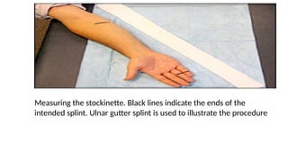 Types, definition of different CAST AND SPLINT- | PPTX