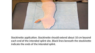 Types, definition of different CAST AND SPLINT- | PPTX