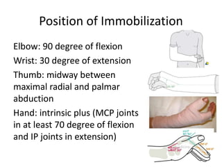Cast application | PPTX