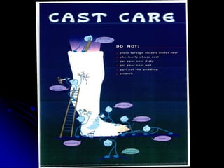 Cast care | PPT