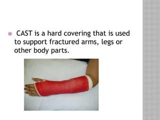 Cast Care Lecture Nursing third year department | PDF
