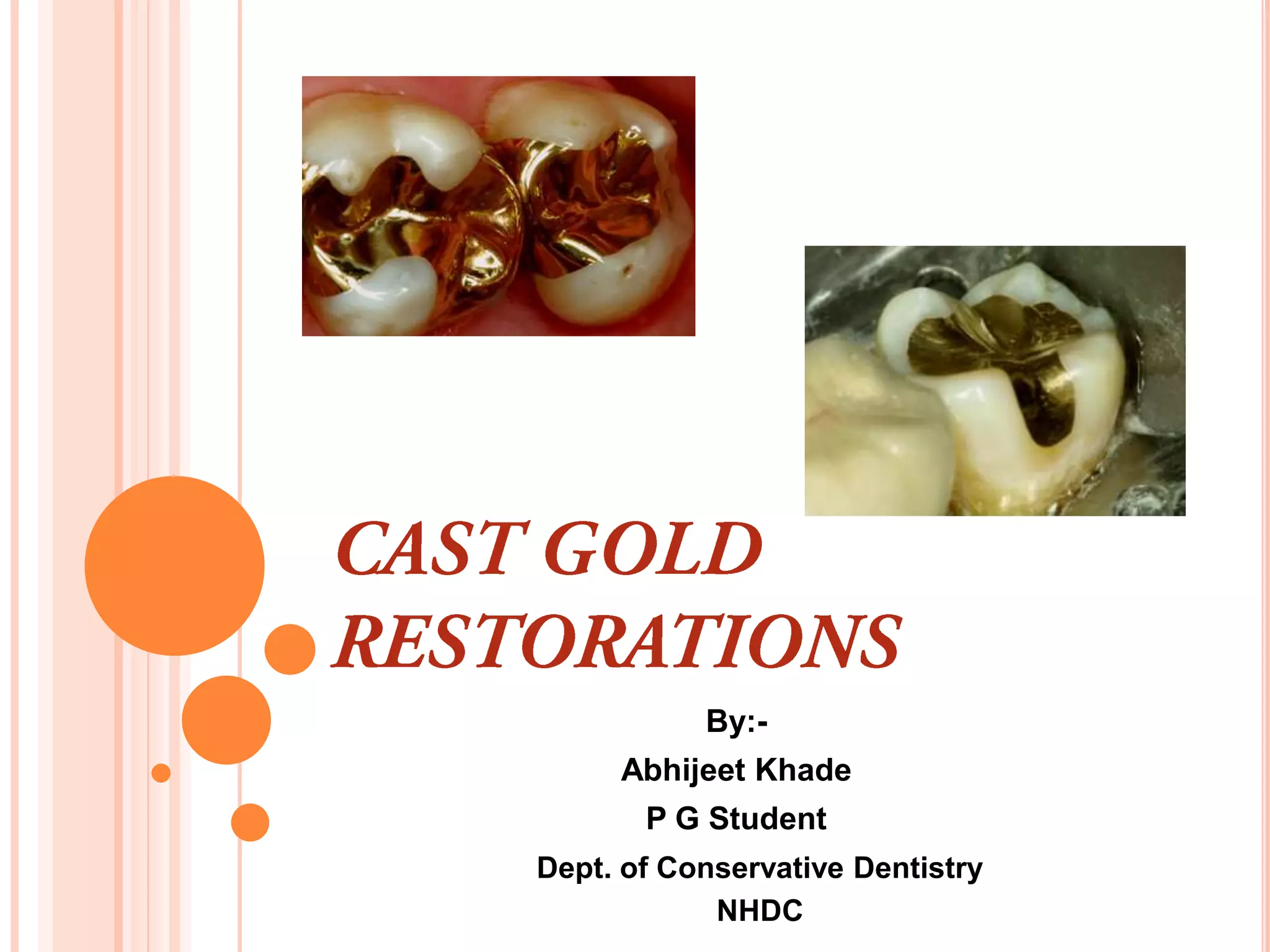 Cast gold Inlay restorations | PPTX