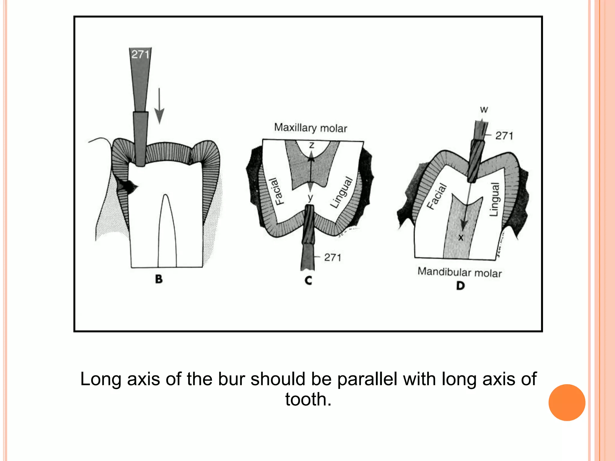 Cast gold Inlay restorations | PPTX