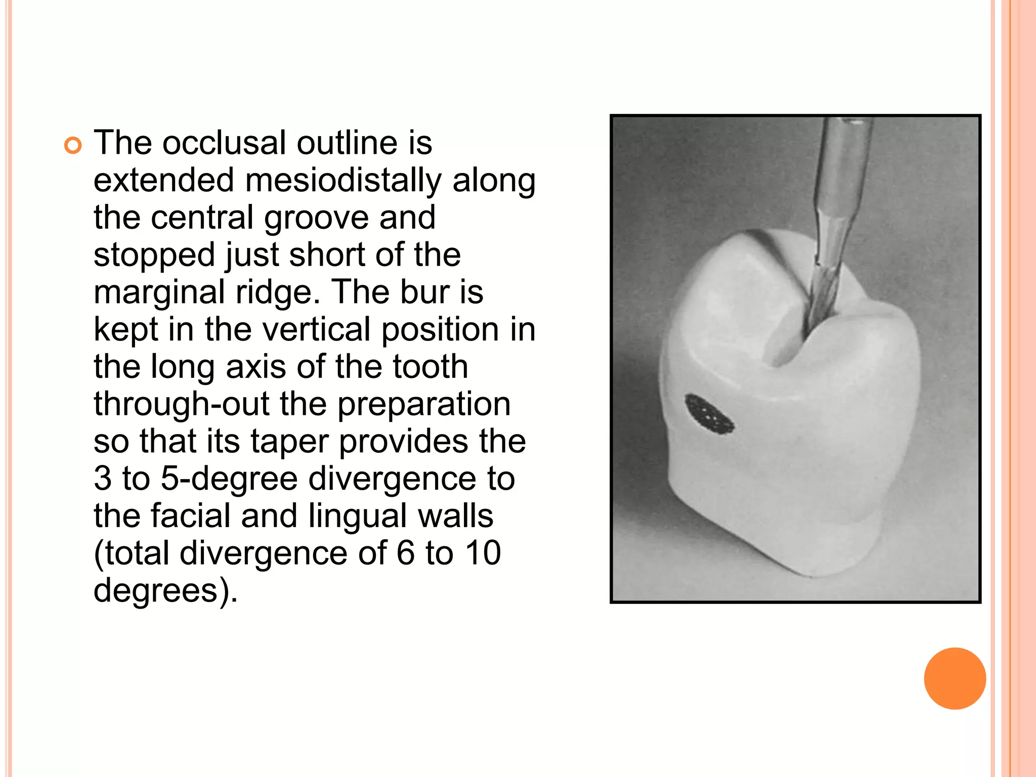 Cast gold Inlay restorations | PPTX