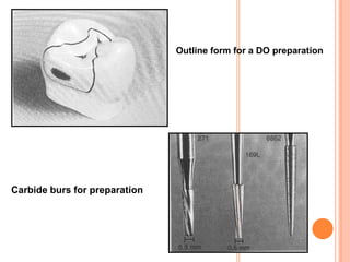 Cast gold Inlay restorations | PPTX