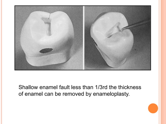 Cast gold Inlay restorations | PPTX